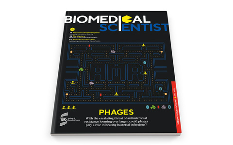 The neonatal blood film | Biomedical Scientist