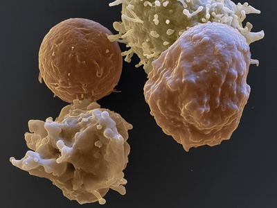 Improving transfusion safety: serious hazards of transfusion report ...