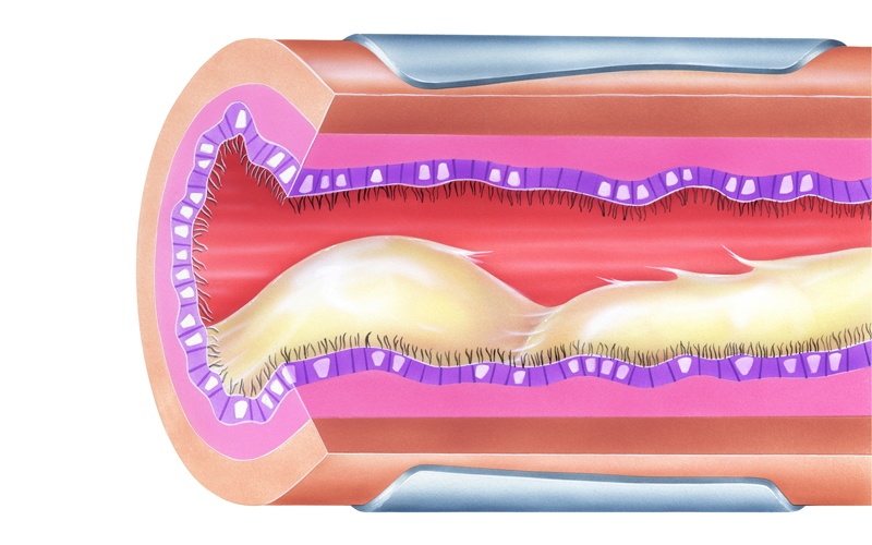 Under the microscope: mucus | Biomedical Scientist