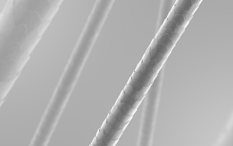 Under the microscope: Hair | Biomedical Scientist