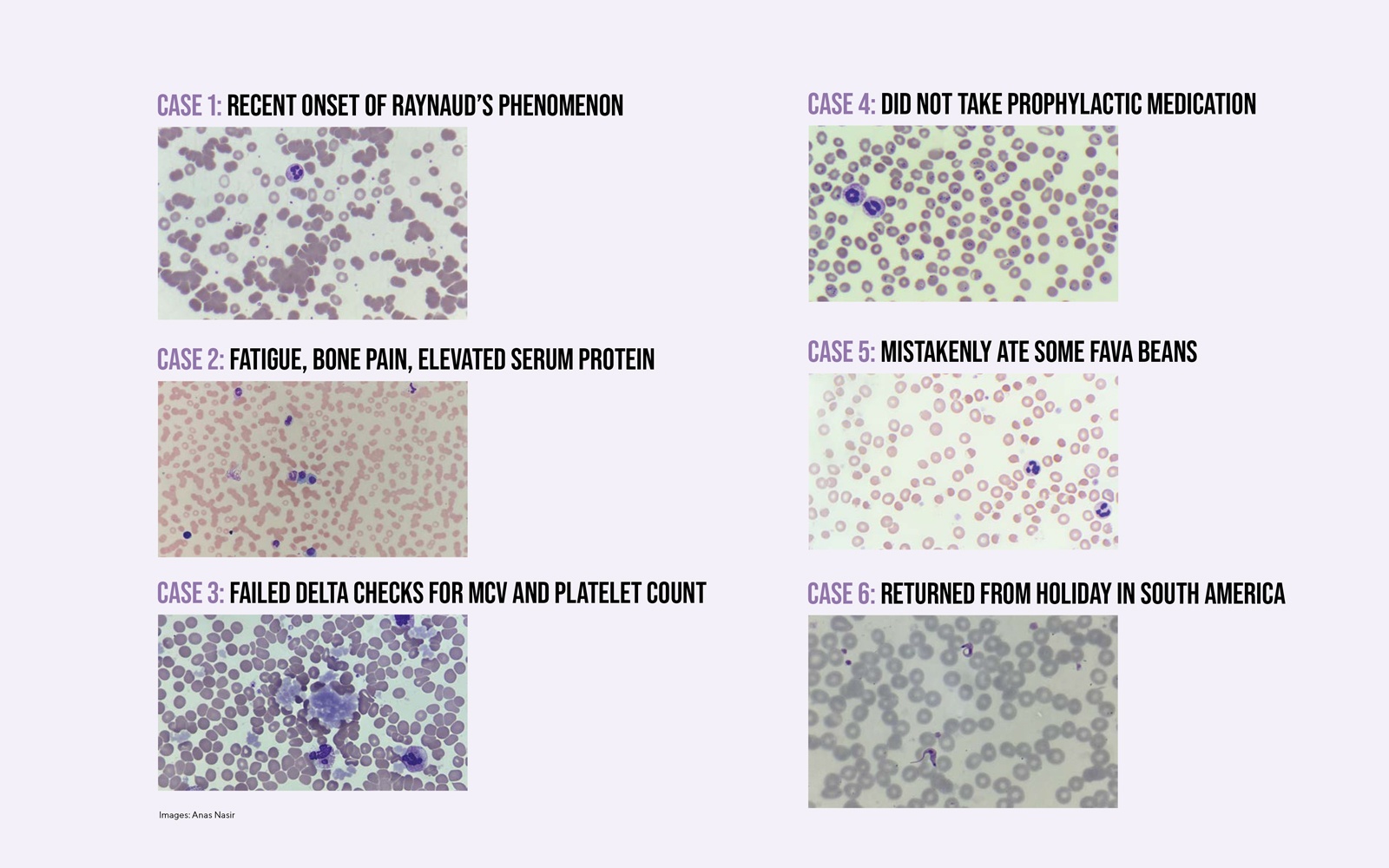 Morphology monday: help, what is it? | Biomedical Scientist