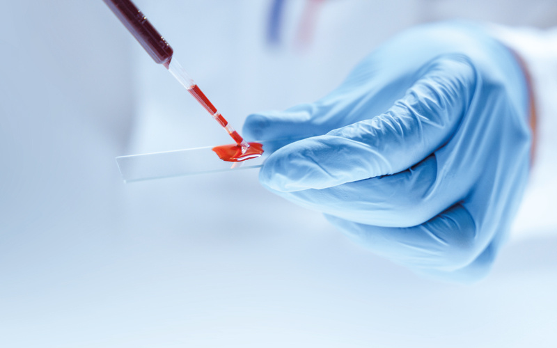 Blood films in the contemporary lab | Biomedical Scientist