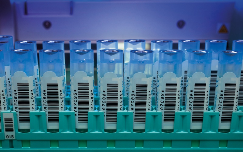 Faecal immunochemical testing | Biomedical Scientist