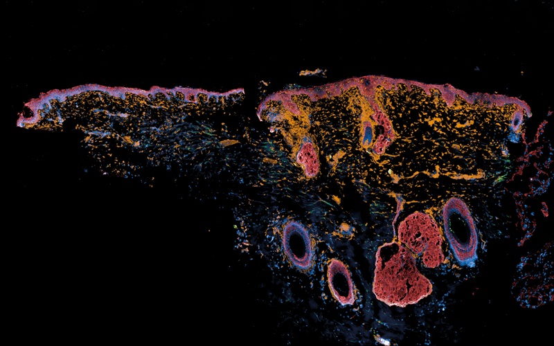 Spatial Transcriptomics A New Frontier Biomedical Scientist