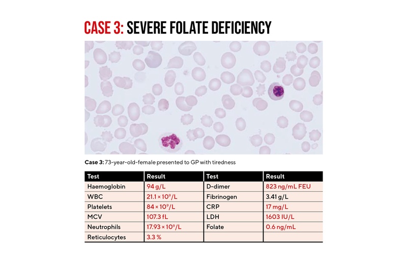 schistocytes normal range