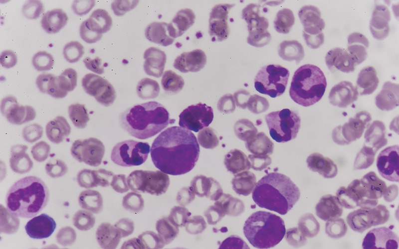 HIV “snipped” from animal cells | Biomedical Scientist