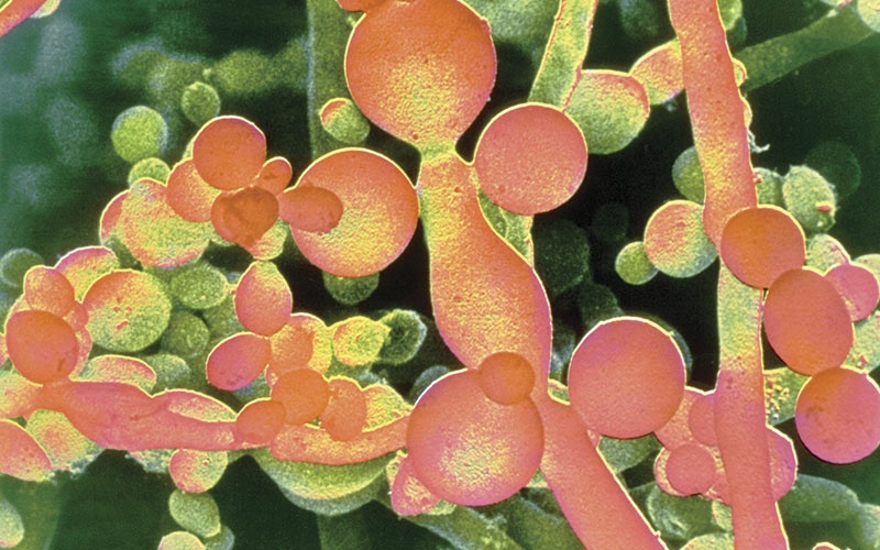 Observing blood infections | Biomedical Scientist