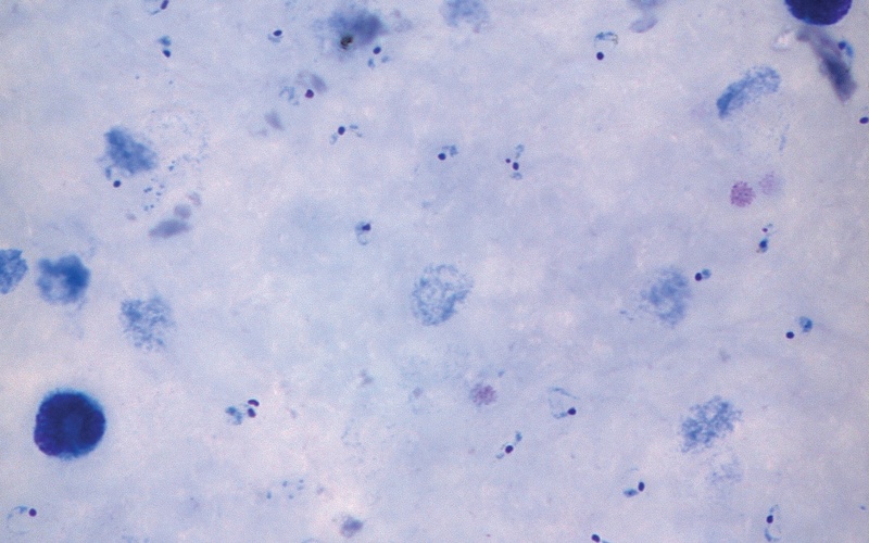 Quality thick films for malaria diagnosis | Biomedical Scientist