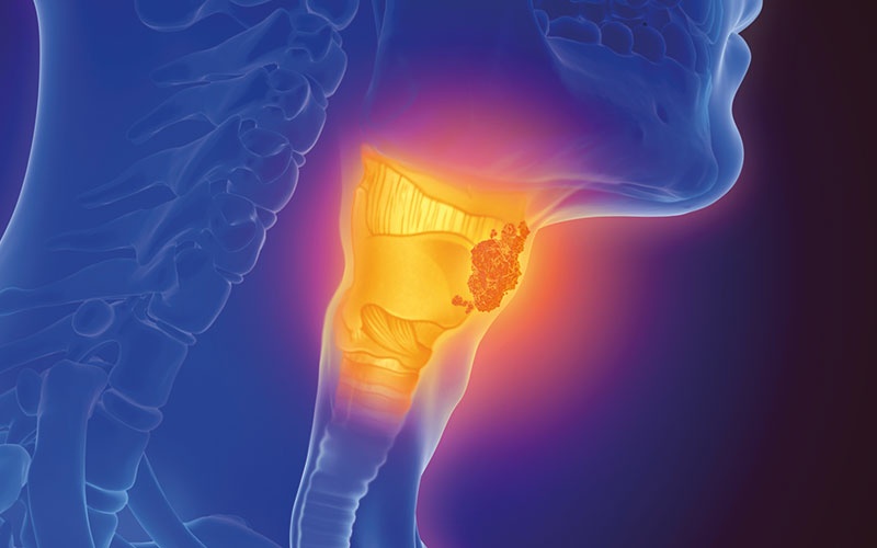 Sponge on a string pill | Biomedical Scientist