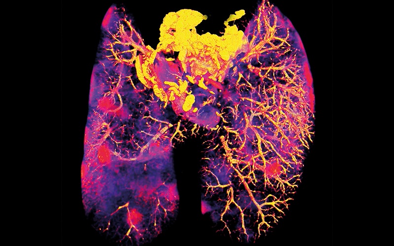 Do antibiotics reach bacteria hiding in tissues? | Biomedical Scientist