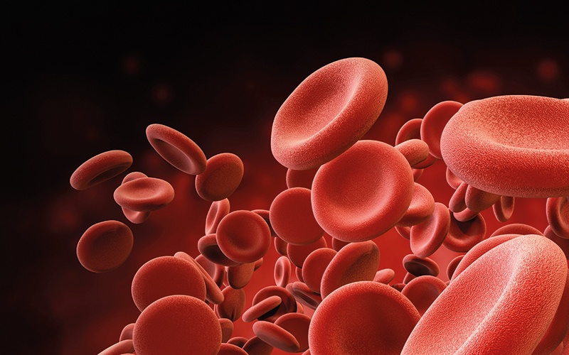 Spherocytes and irregularly contracted cells | Biomedical Scientist