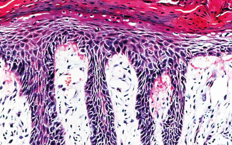 Skin susceptibility to diseases | Biomedical Scientist