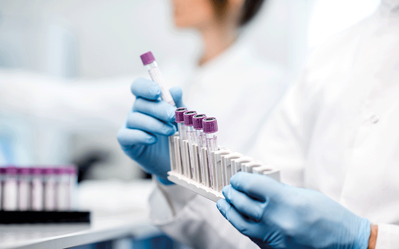 ISO 20658:2023 sample collection and transport | Biomedical Scientist