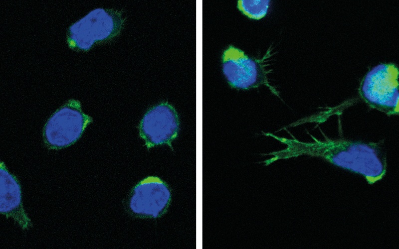 Newly discovered genetic defect | Biomedical Scientist
